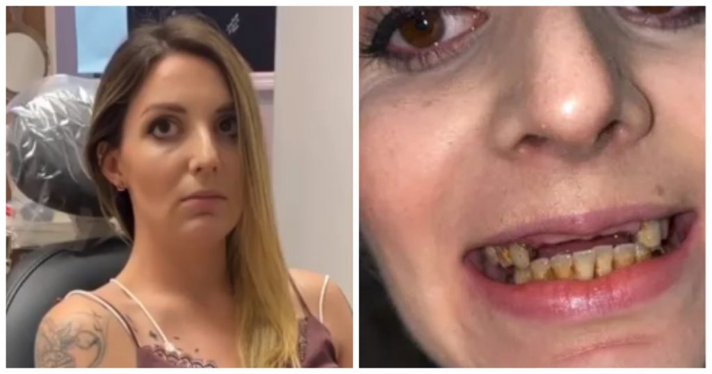 Une jeune femme aux dents abîmées retrouve son sourire grâce à un ...