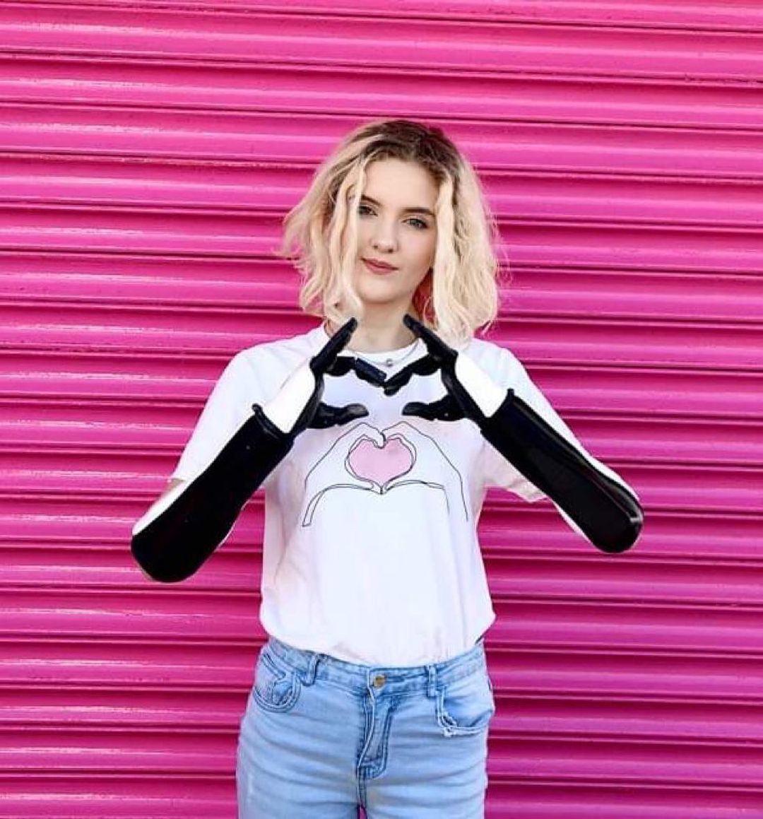 L'adolescente aux bras bioniques témoigne : « c'est cool d'être ...