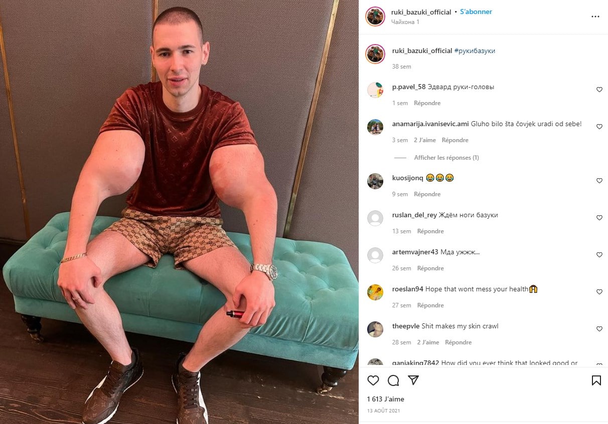 Kirill Tereshin : le Popeye russe enchaîne les opérations pour ...