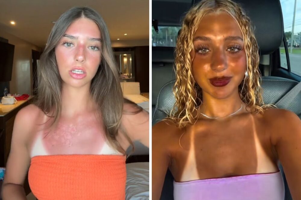 "BURN LINES" : La nouvelle tendance TikTok qui choque les parents et ...